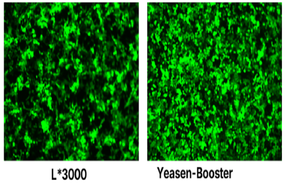 Cell Transfection | 293T Human Embryonic Kidney Cells Transfection (11