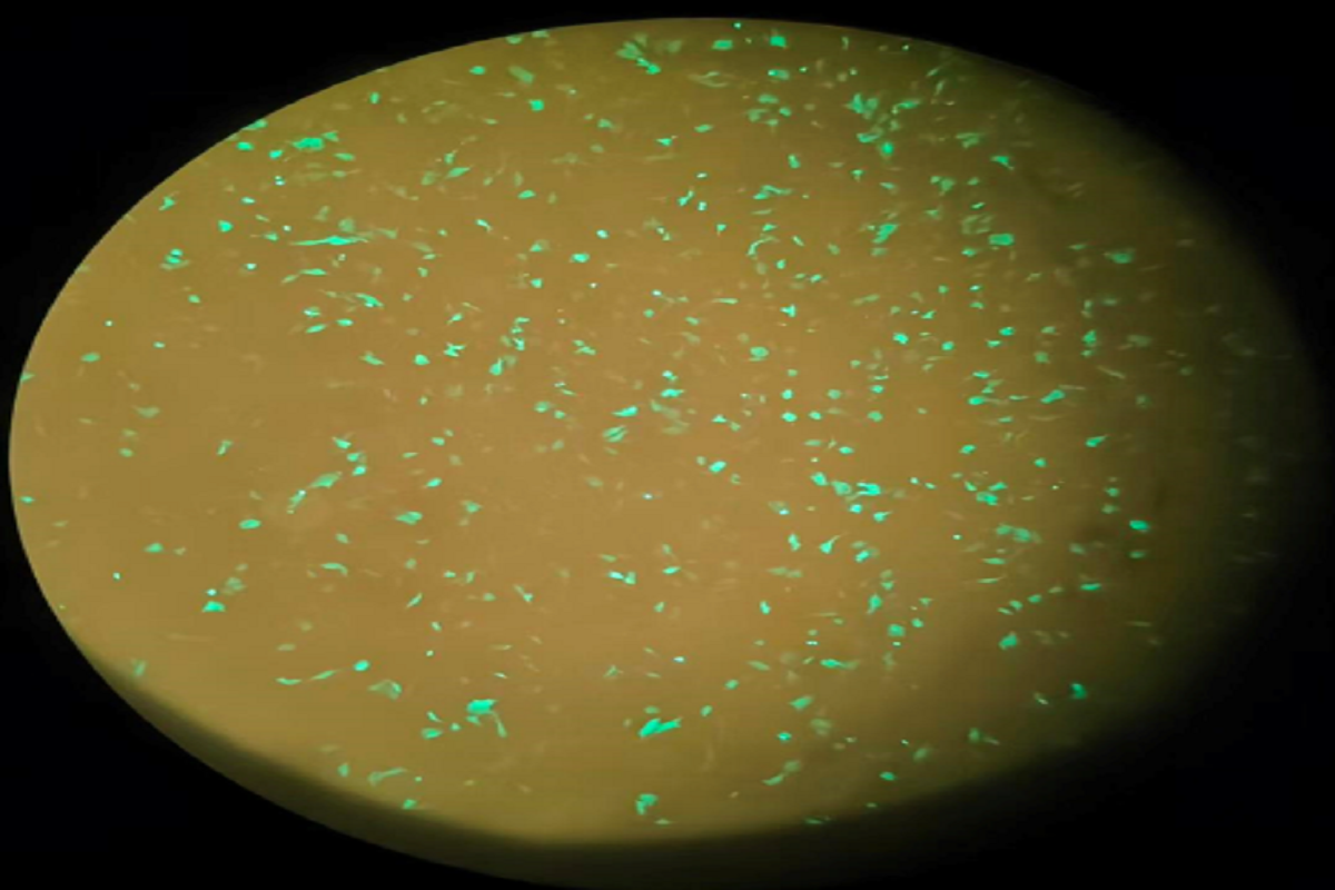 Cell Transfection | U2OS Human Osteosarcoma Cells Transfection– DNA
