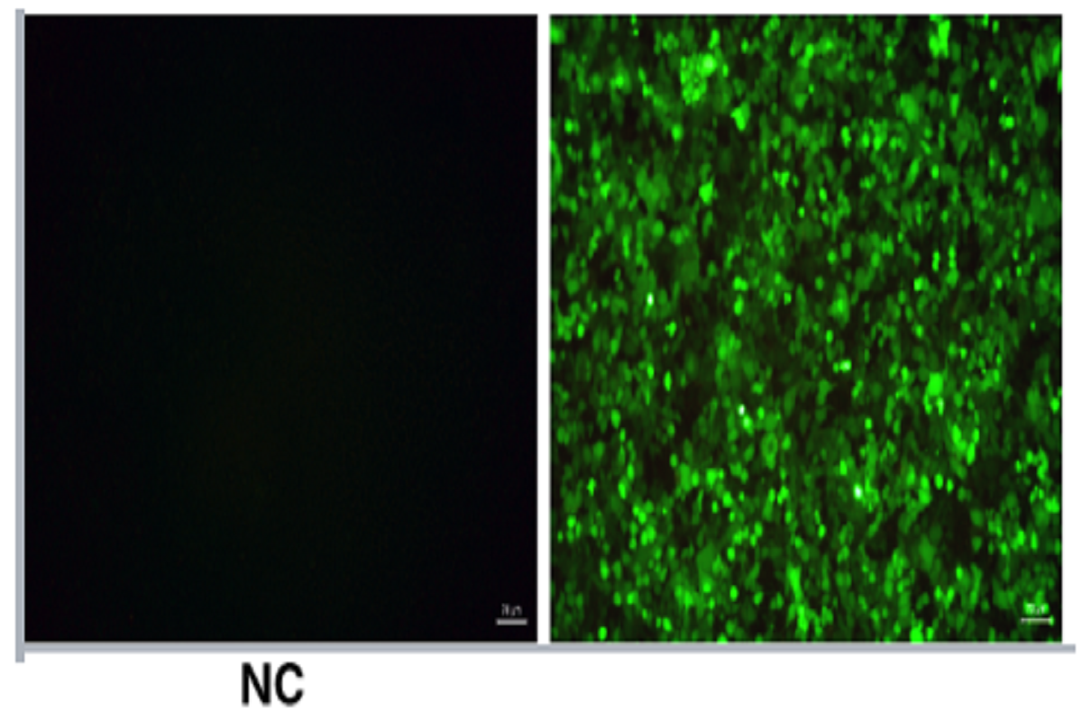 Cell Transfection | 293T Human Embryonic Kidney Cells Transfection– mR